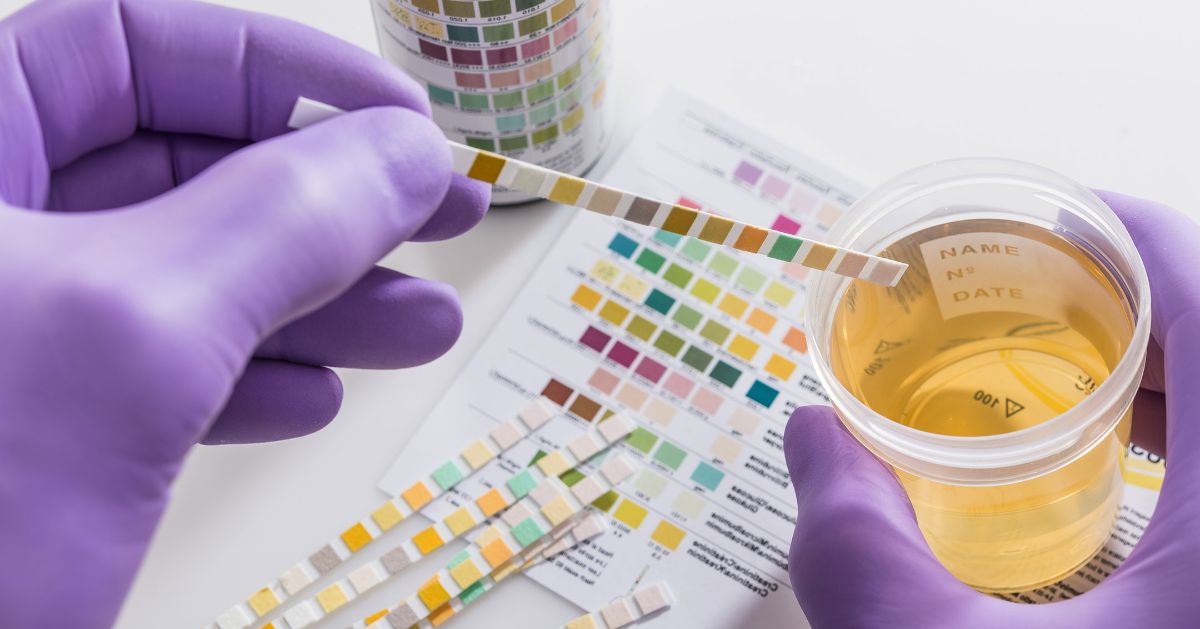 Warum Urin stinkt und was die Farben bedeuten | Migros iMpuls