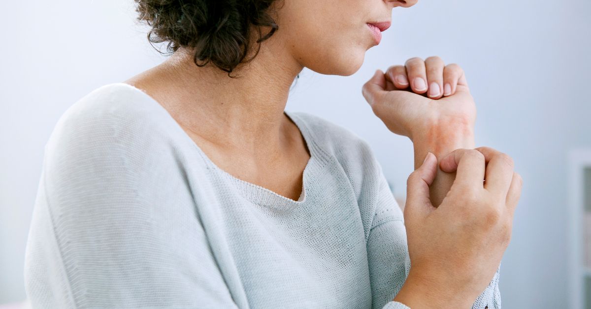 Nesselsucht: Ursache, Symptome & Behandlung | Migros iMpuls