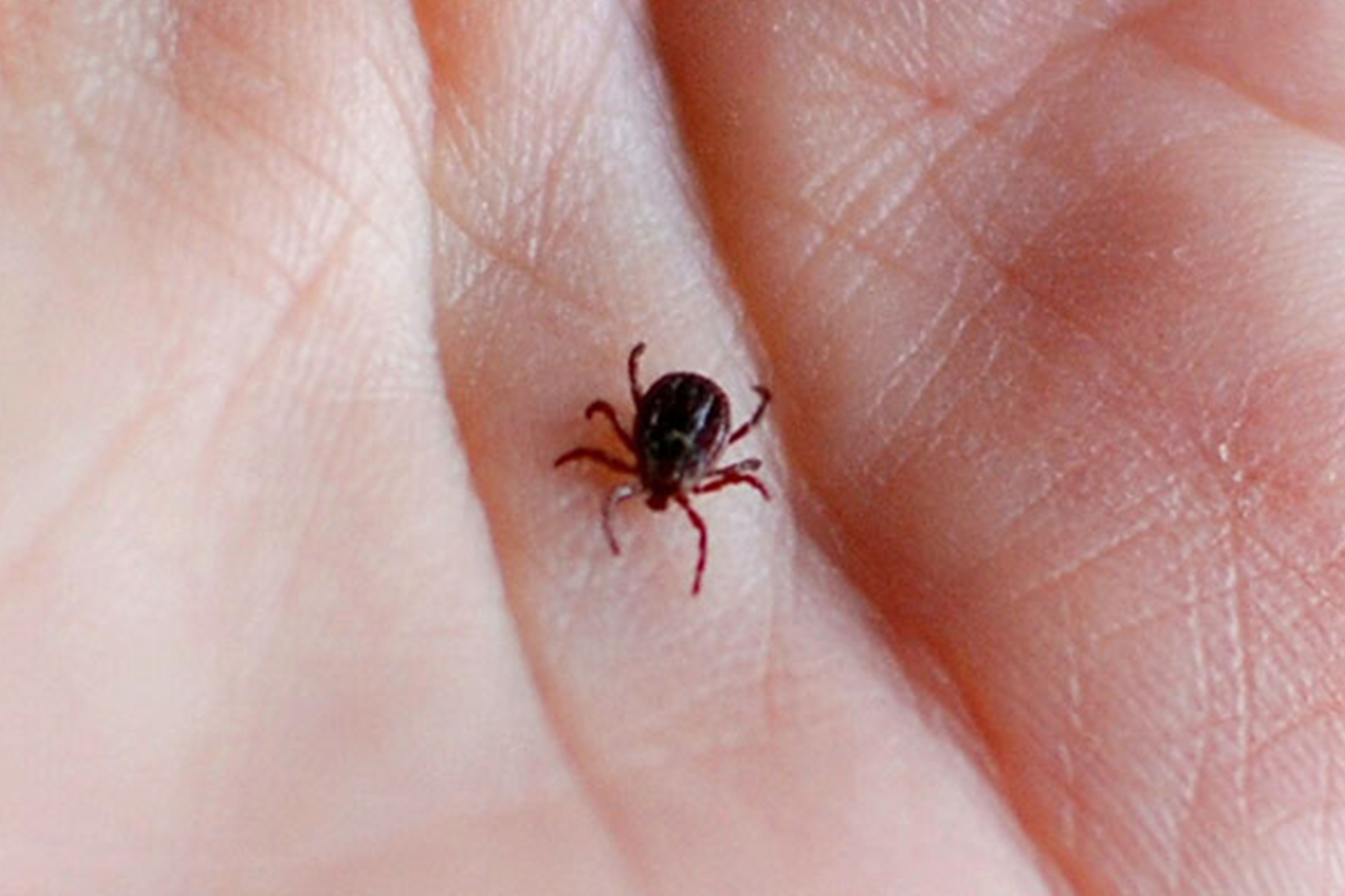 Was tun bei einem Zeckenbiss? | Migros iMpuls