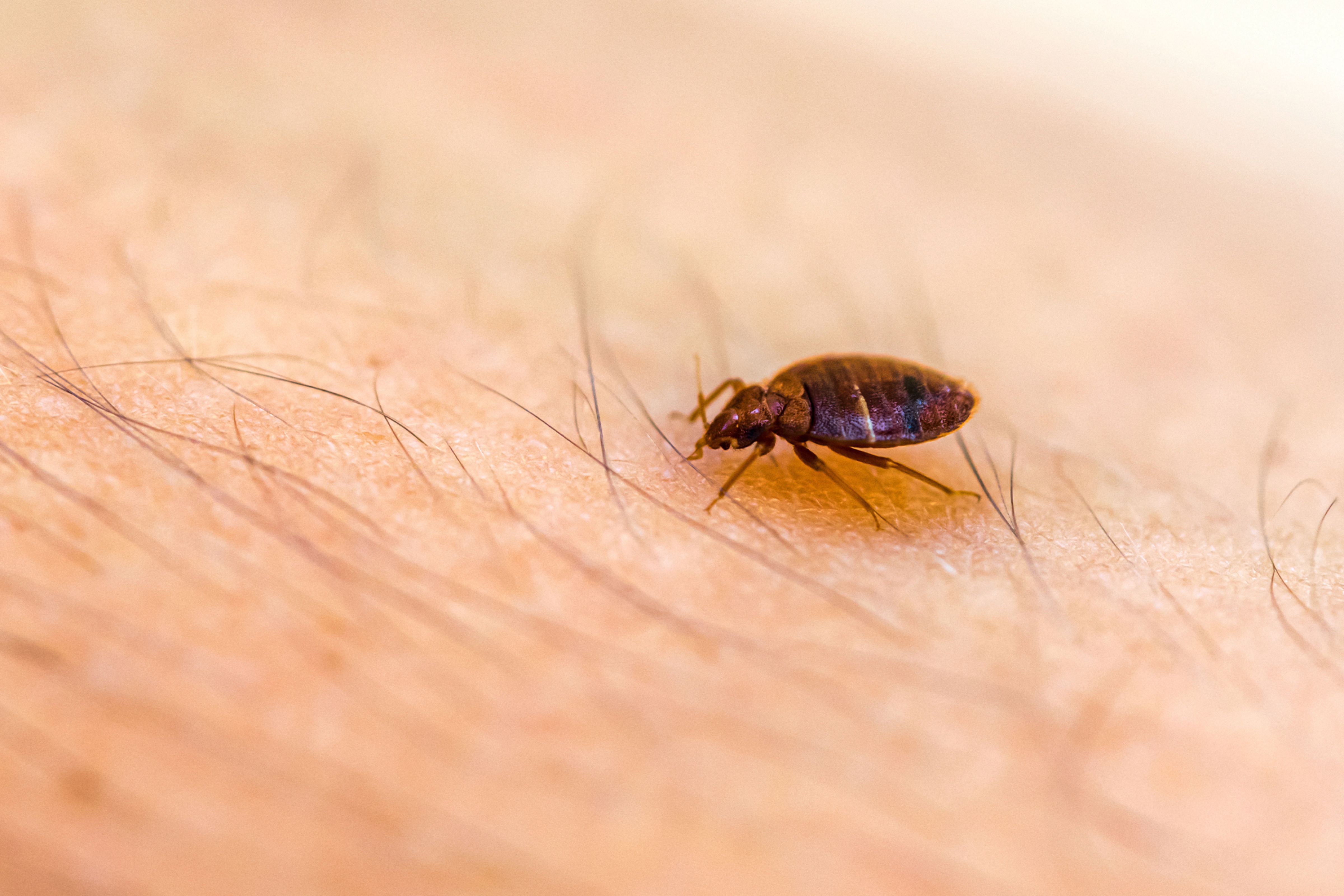 Läuse erkennen und bekämpfen: So klappt es | Migros iMpuls