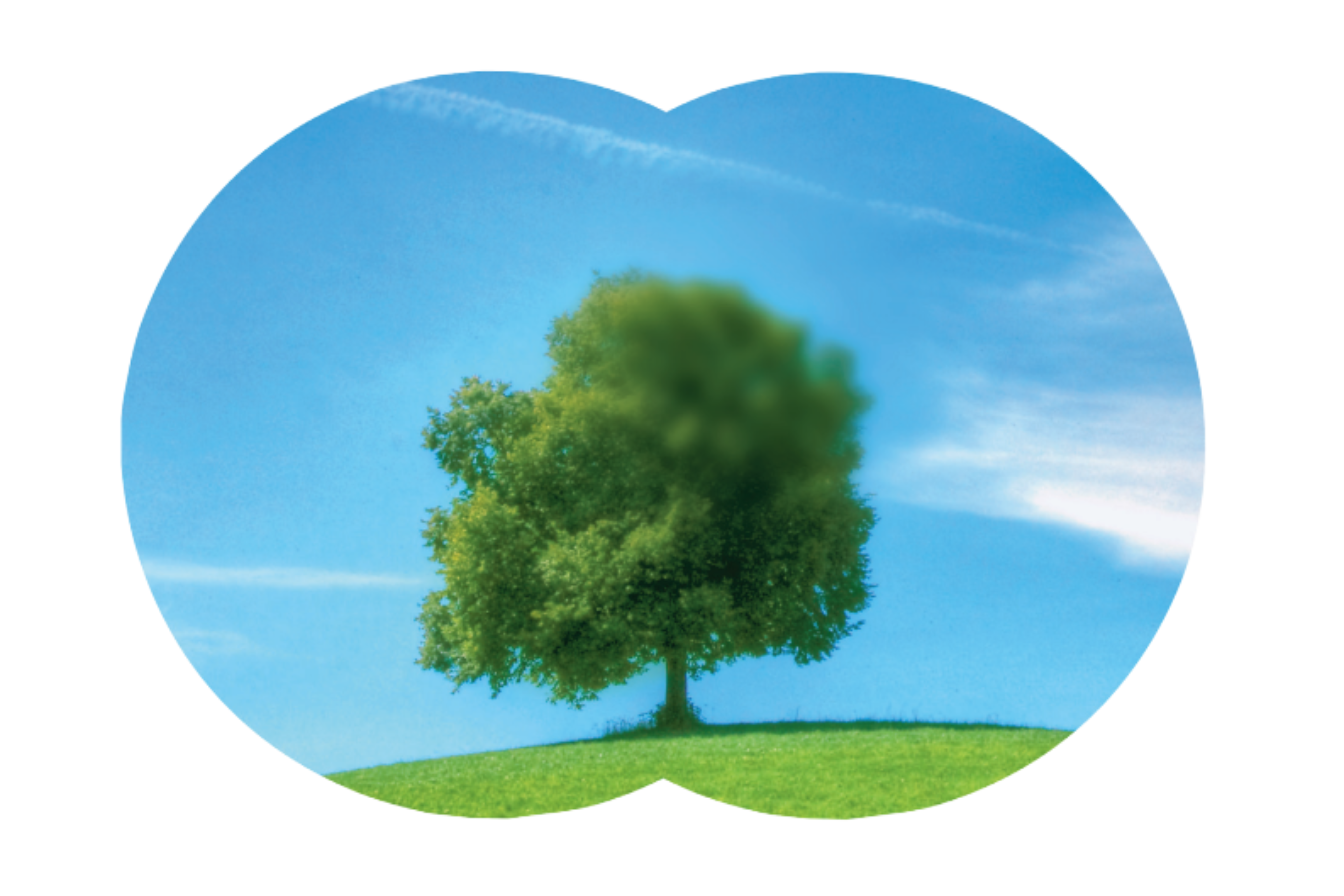 Tout sur les scintillements oculaires | Migros iMpuls