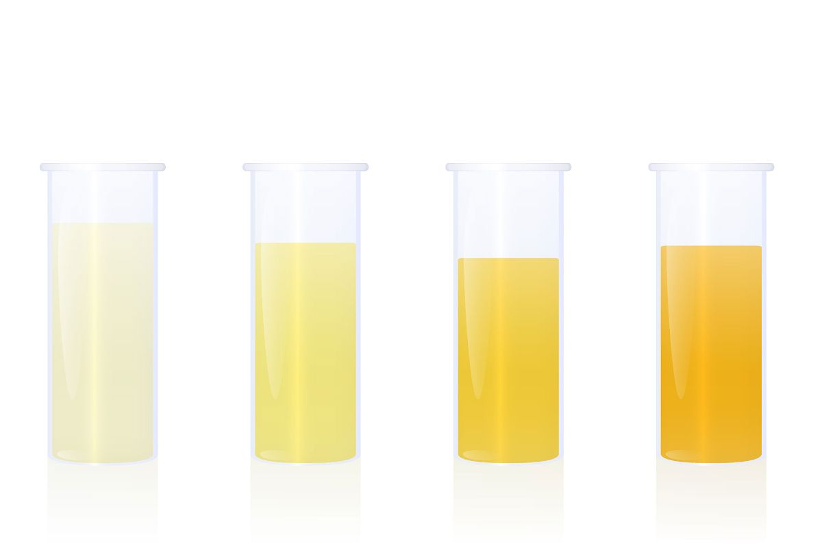 Warum Urin stinkt und was die Farben bedeuten | Migros iMpuls