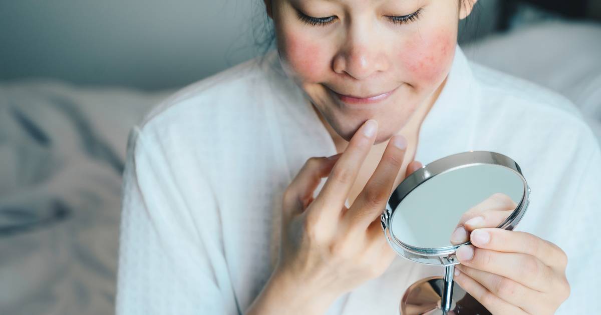 Éruptions cutanées fréquentes sur le visage | Migros iMpuls